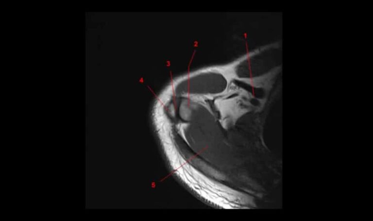 Shoulder and arm - W-Radiology