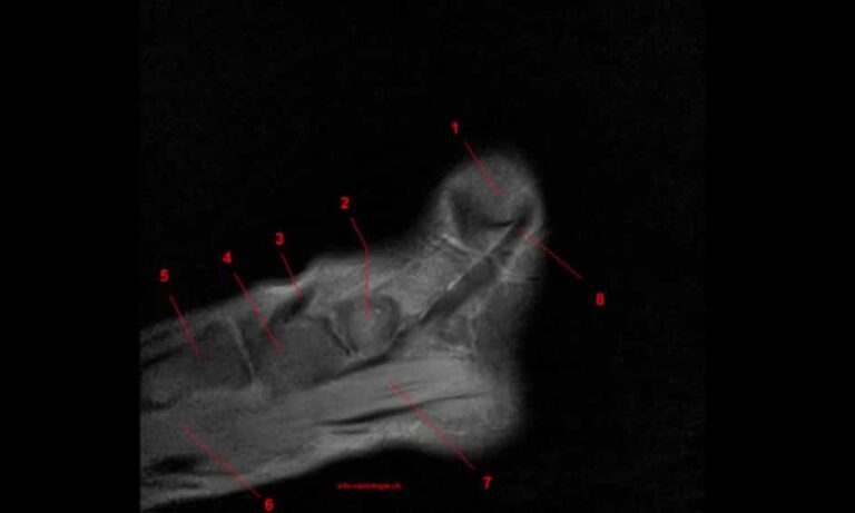 Entero-MRI: detailed anatomy - W-Radiology