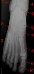 Foot X-ray - W-Radiology